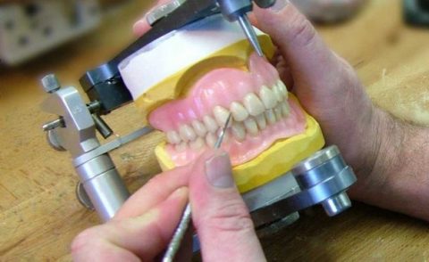 New Dentures | SB Denture Design Ltd | dental laboratory